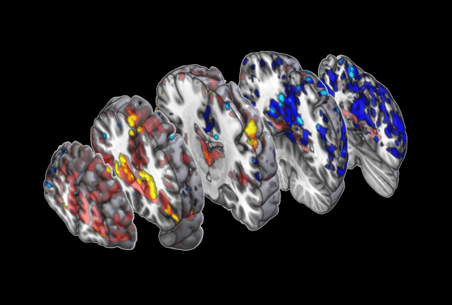 Bangor Imaging Cerebral Physiology Lab – Trying to understand the brain ...